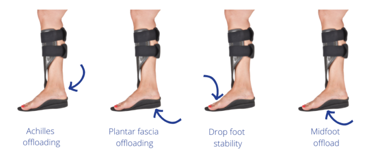 The Richie AeroSpring Brace - Queensland Orthotic Lab